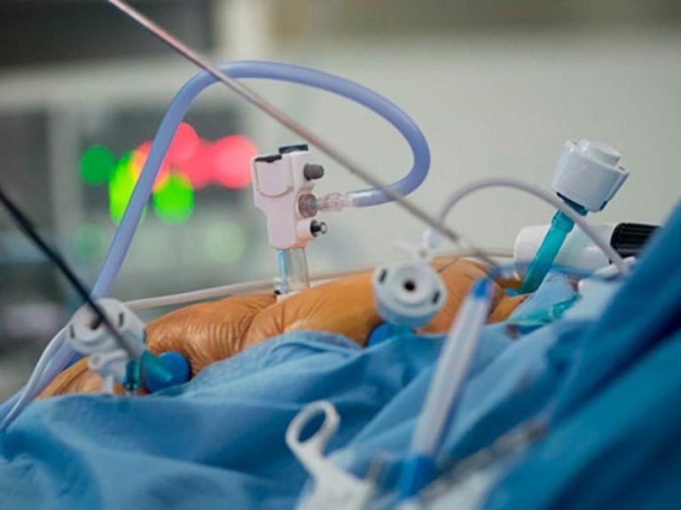 HIPEC (Quimioterapia Intraperitoneal Hipertérmica) - Sociedad Quirúrgica